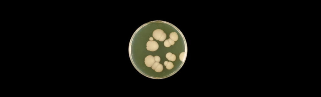 Kandida - simptomi, upute i liječenje - Chios mastika - 2021